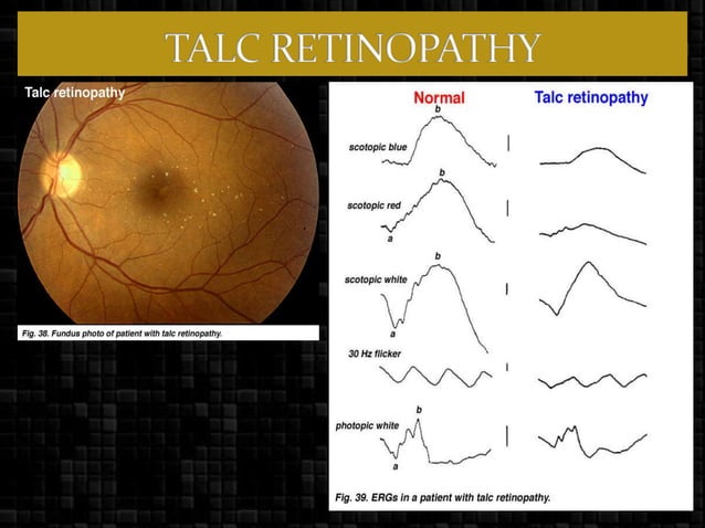 ELECTRORETINOGRAPHY (in veterinary).pptx