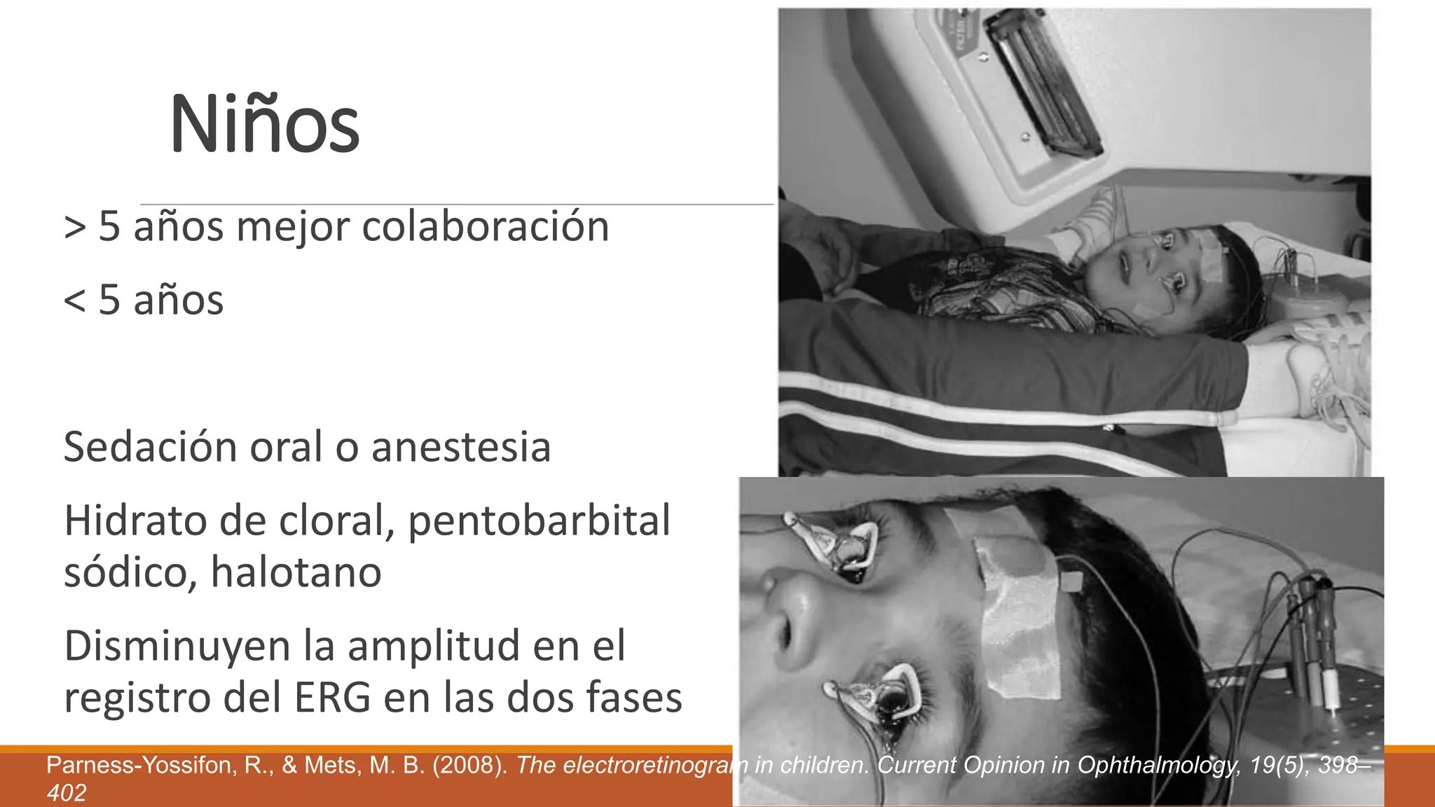 Electrofisiologia de la vision: Electrorretinograma (ERG) y ...