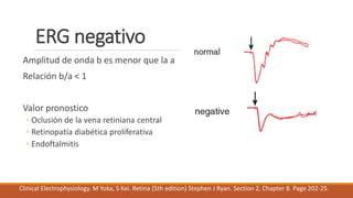 Electrofisiologia de la vision: Electrorretinograma (ERG) y ...