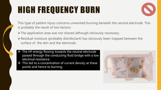 Electrosurgery | PPTX | First Aid | Injuries