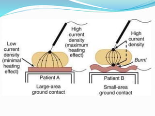 Electrosurgery | PPTX
