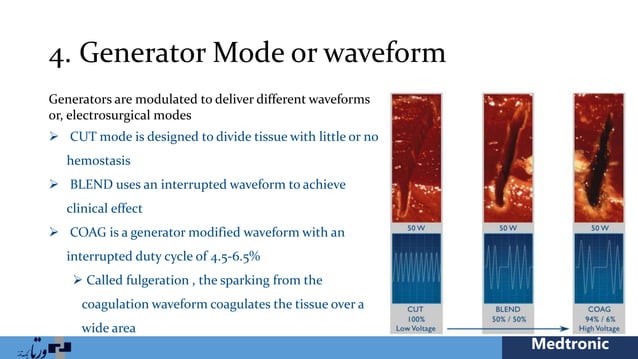 Electrosurgery | PPSX