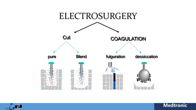 Electrosurgery | PPSX