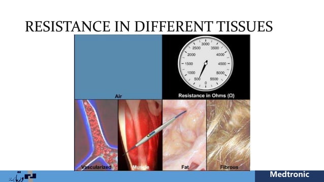 Electrosurgery | PPSX