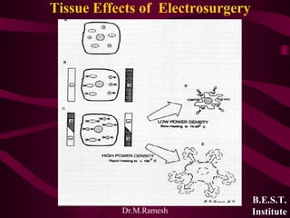 Electrosurgery.ppt
