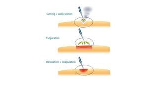 Electrosurgical Unit.pptx