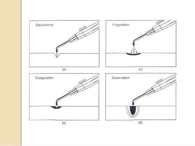 Electrosurgical unit
