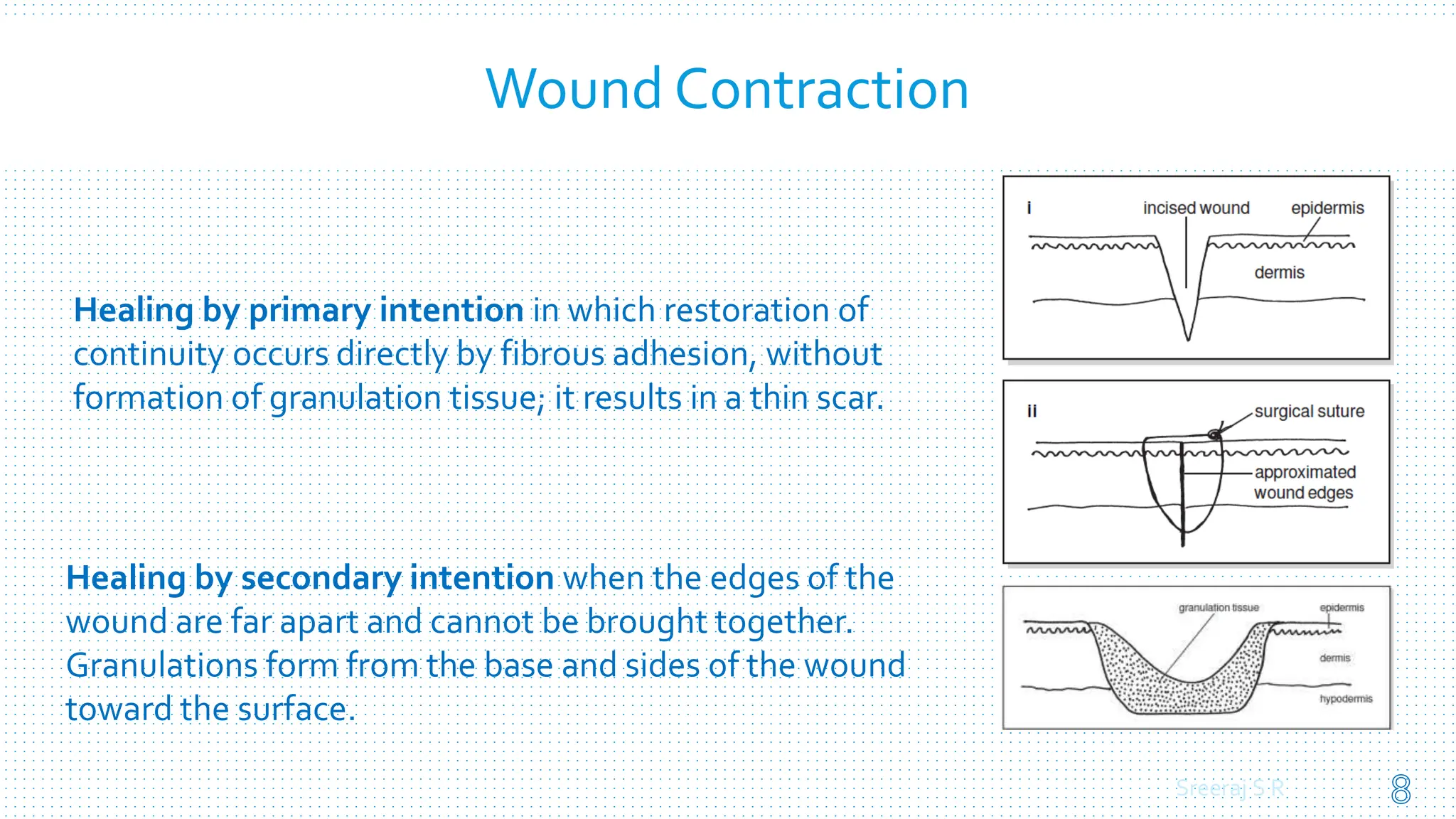 Physiotherapy in Wound Healing; Role of Electrotherapy | PPTX