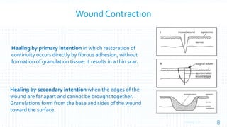 Physiotherapy in Wound Healing; Role of Electrotherapy | PPTX
