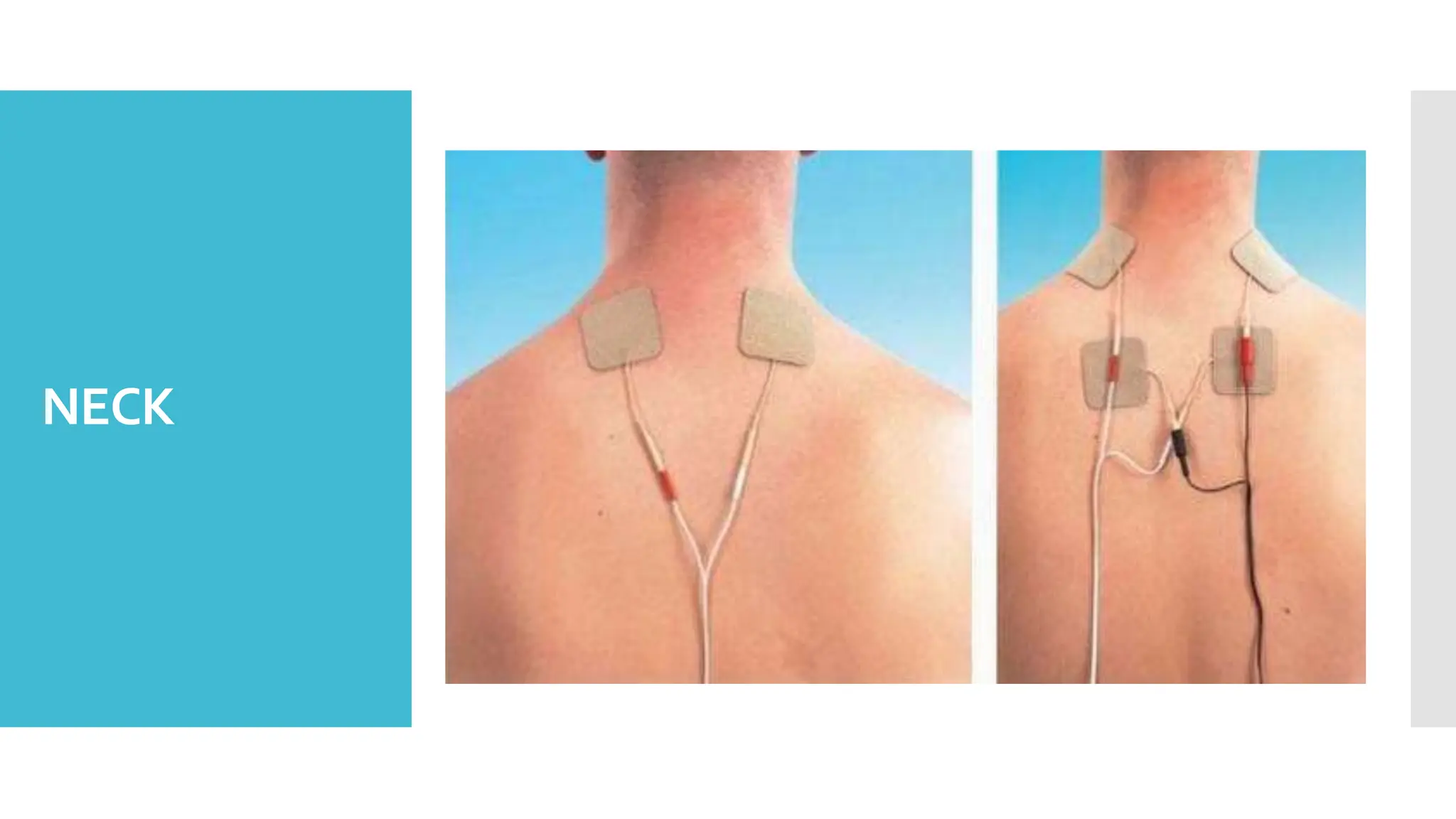 ELECTROTHERAPY PPT by sonot thakuria Amch | PPTX