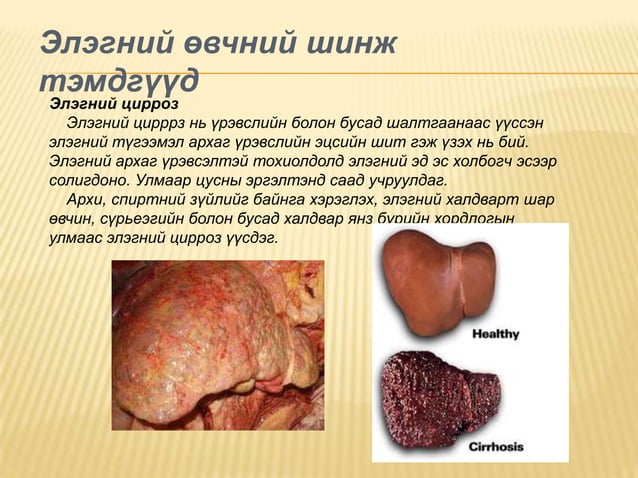 Elegnii tuhai pp | PPTX