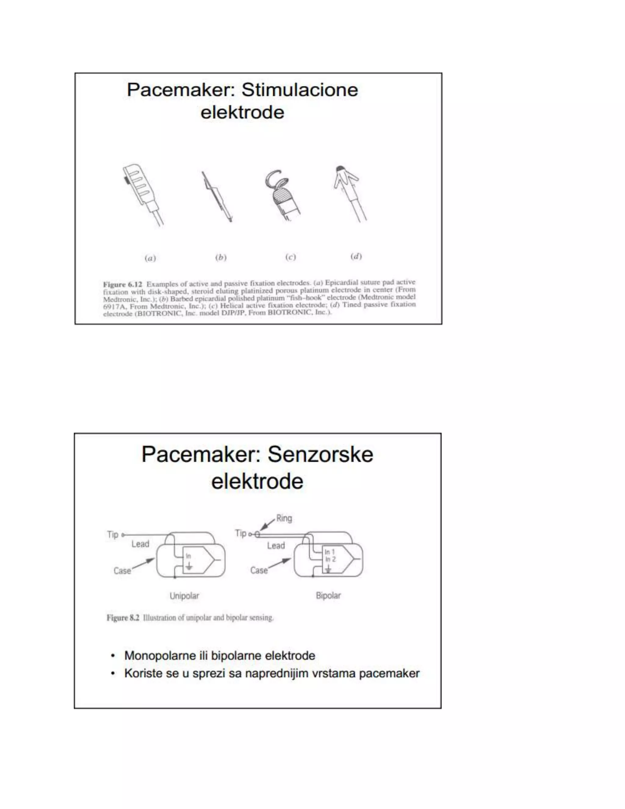Elektricna stimulacija srca | DOCX