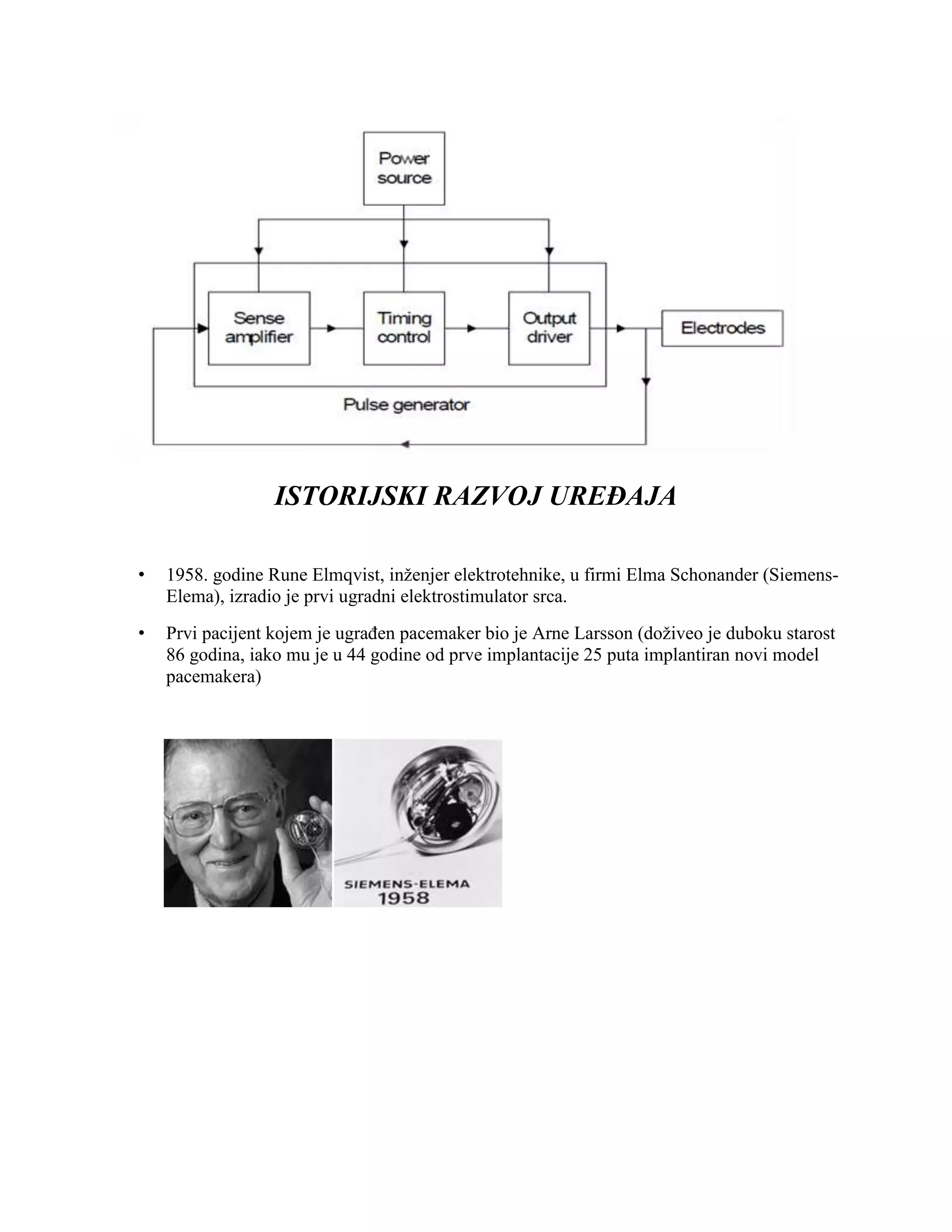 Elektricna stimulacija srca | DOCX
