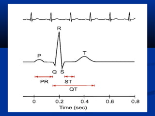 Električna defibrilacija i kardioverzija | PPT