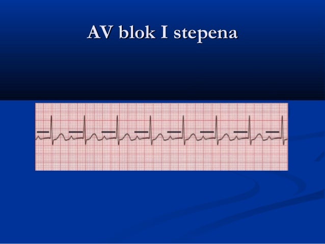 Električna defibrilacija i kardioverzija