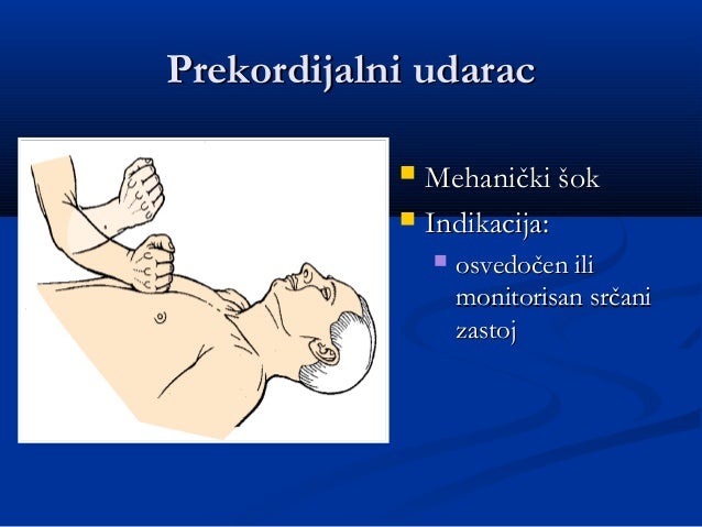Električna defibrilacija i kardioverzija