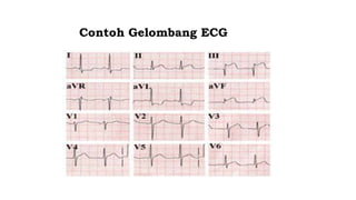 Tentang Elektrocardiografi ( ECG ) | PPTX