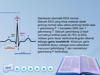 Elektrocardiogram (ecg) | PPTX