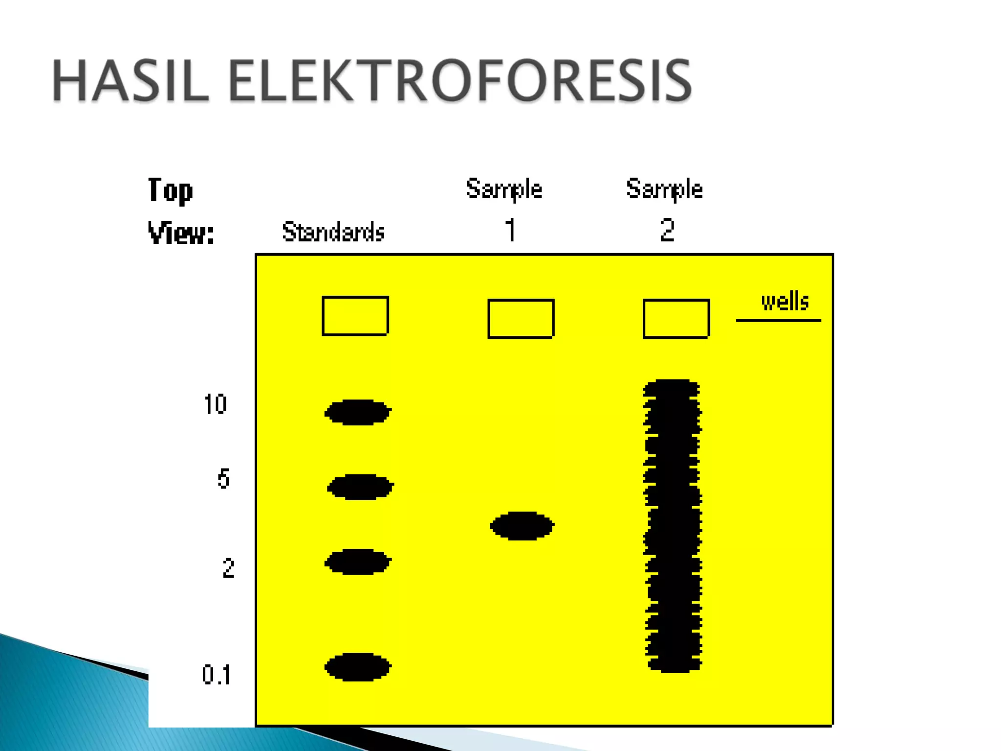 Elektroforesis | PPT