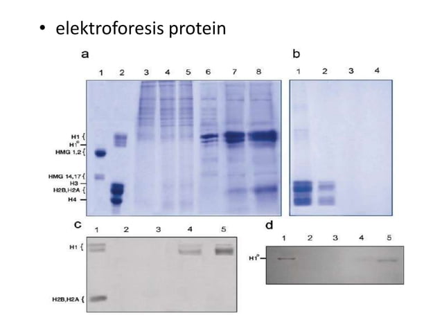 Elektroforesis gel | PPTX