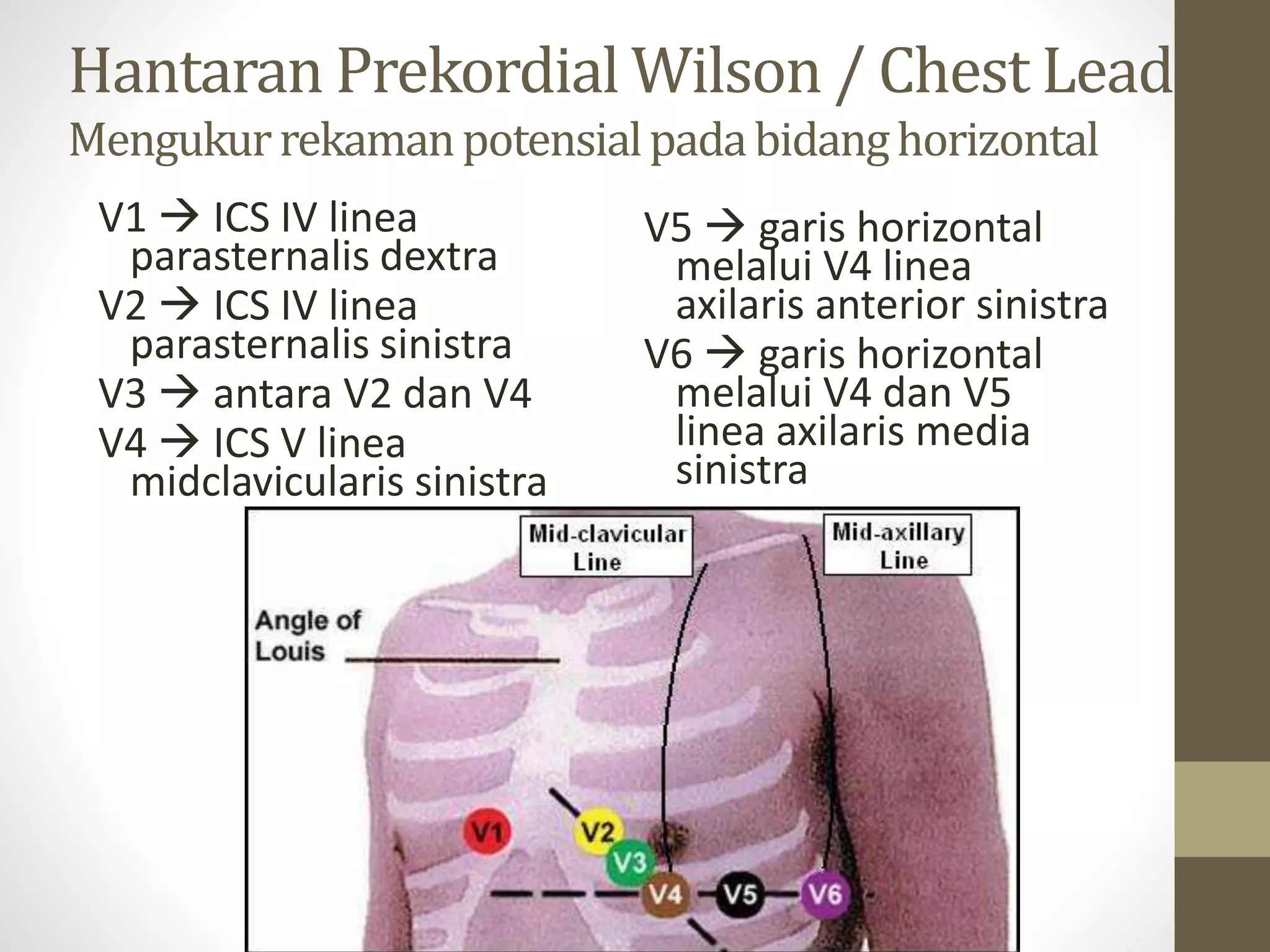 ELEKTROKARDIOGRAFI.pptx