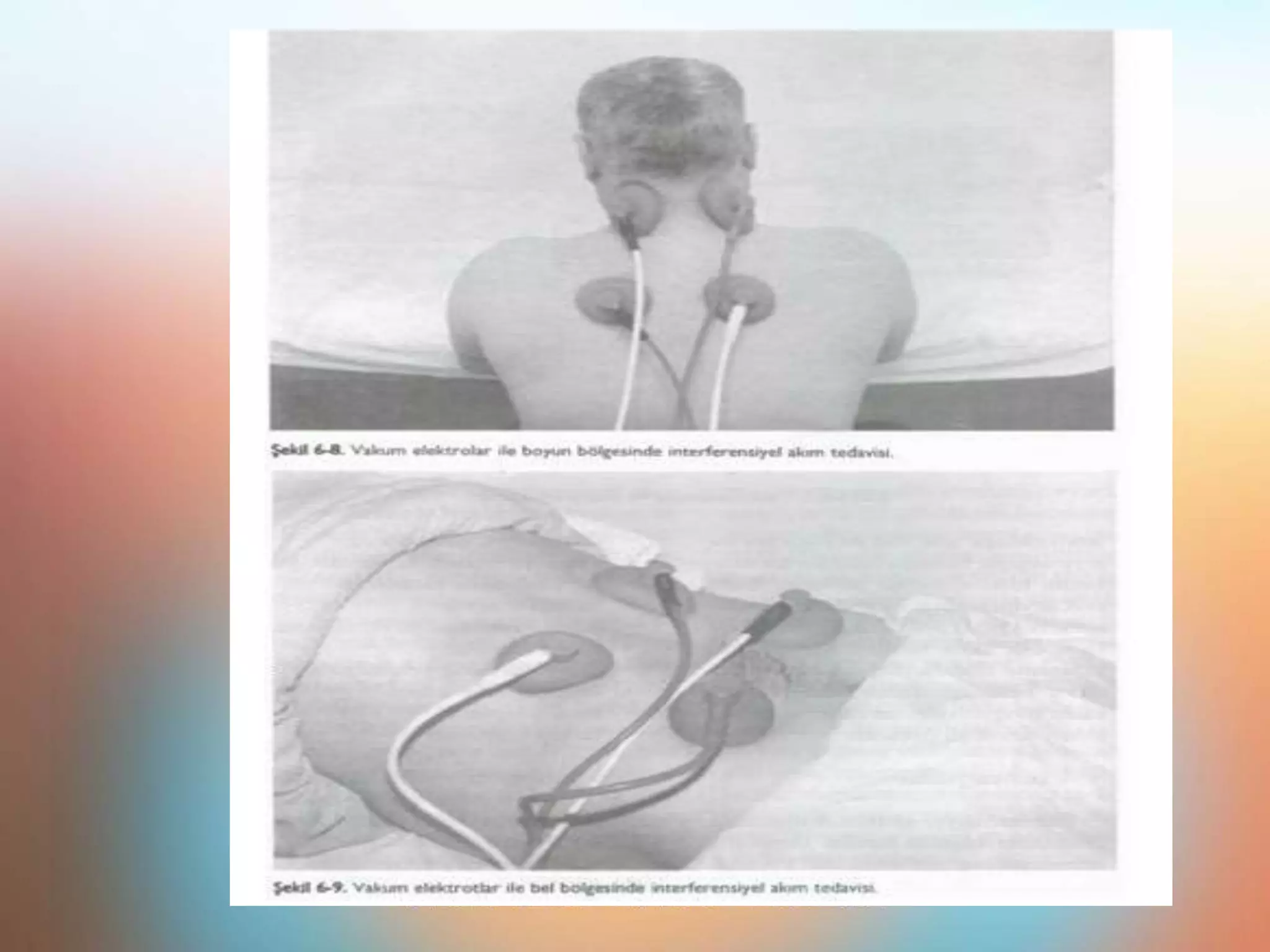 Elektroterapi - 2.pptx