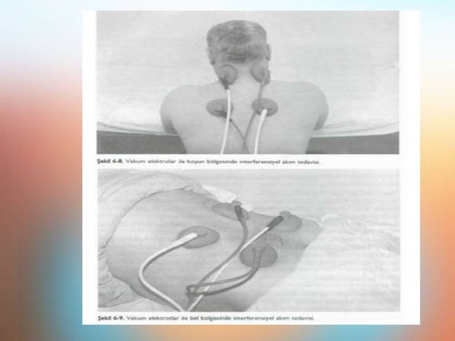 Elektroterapi - 2.pptx