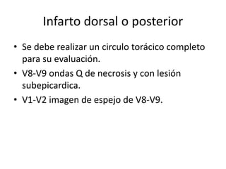 El electrocardiograma en la cardiopatía isquémica | PPTX