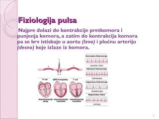 Elementarni pojmovi ekg | PPT