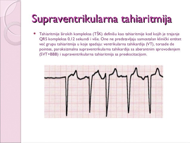 Elementarni pojmovi ekg