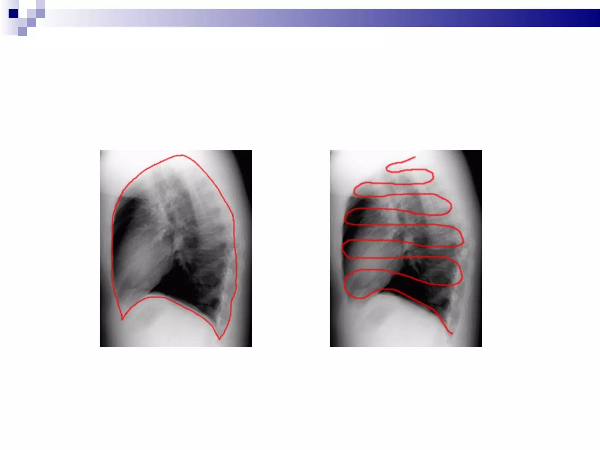 Elemente de radiologie pentru rezidenti | PPT