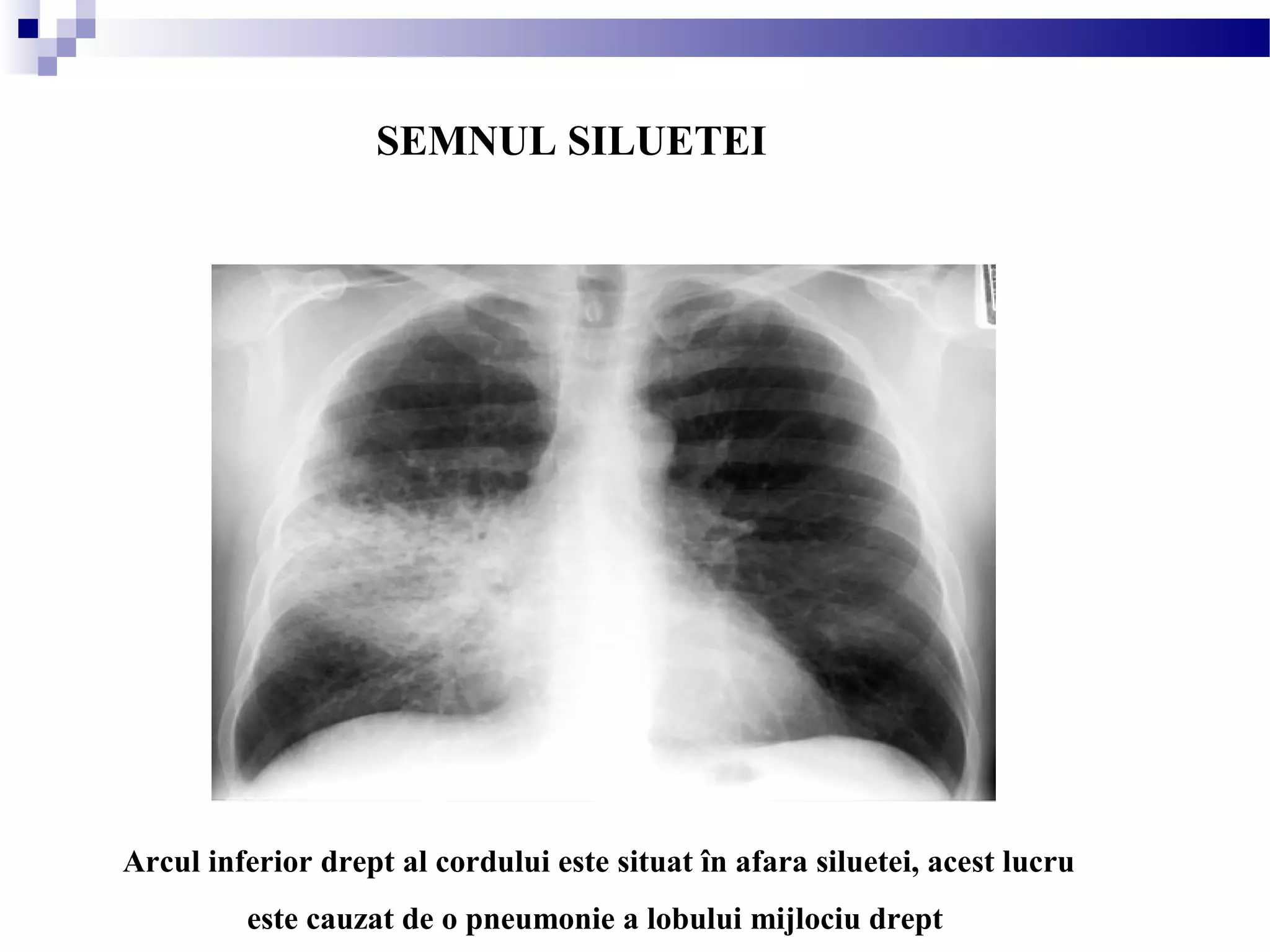 Elemente de radiologie pentru rezidenti | PPT