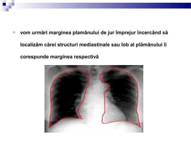 Elemente de radiologie pentru rezidenti | PPT