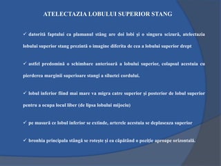 Elemente de radiologie toracică pentru rezidenţi | PPTX