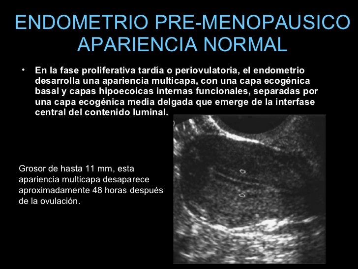 Patología endometrial