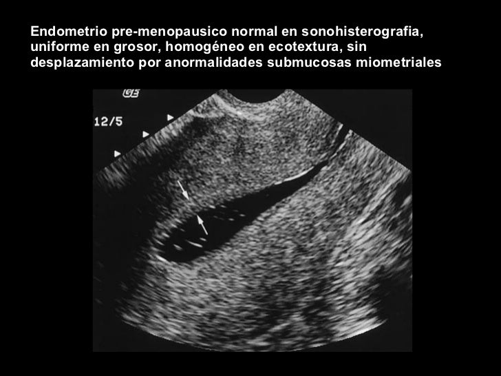 Patología endometrial