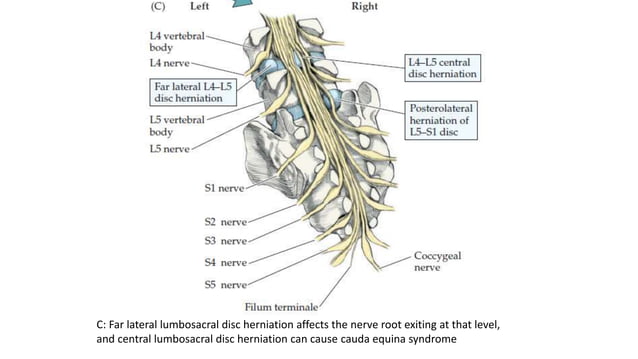 Eleni PN.pptx | Death, Injury, or Military Conflict | Sensitive Topics