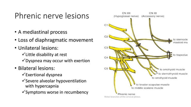 Eleni PN.pptx | Death, Injury, or Military Conflict | Sensitive Topics