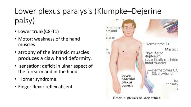 Eleni PN.pptx | Death, Injury, or Military Conflict | Sensitive Topics