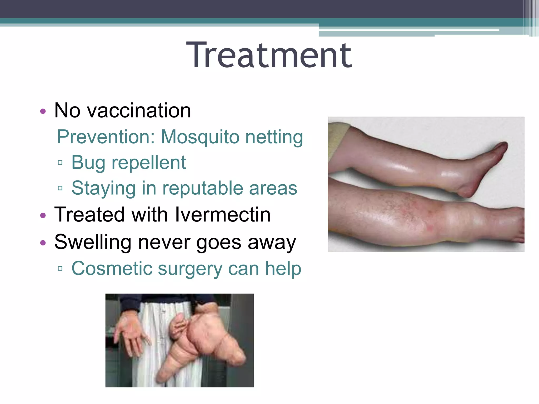 Elephantiasis | PPTX