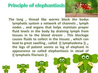 Elephantiasis | PPTX