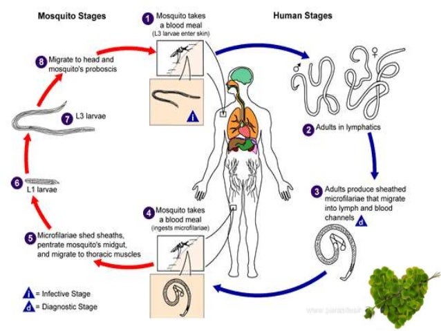 What Is Elephantiasis How To Combat The Elephantiasis