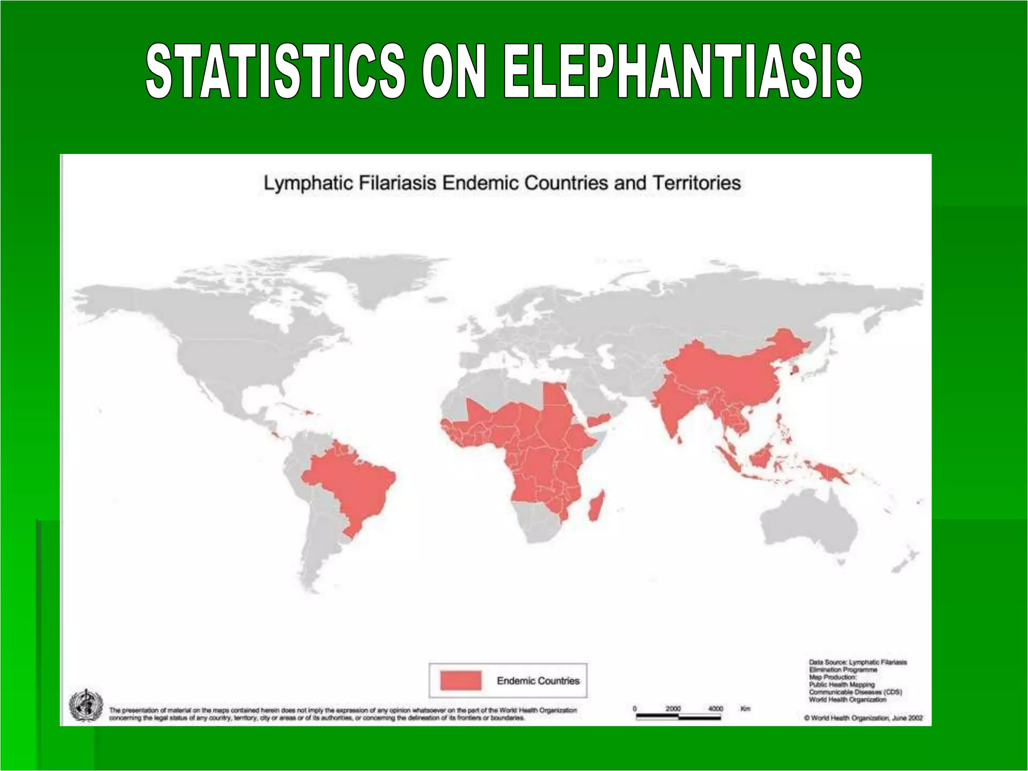 Elephantiasis presentation1 | PPSX