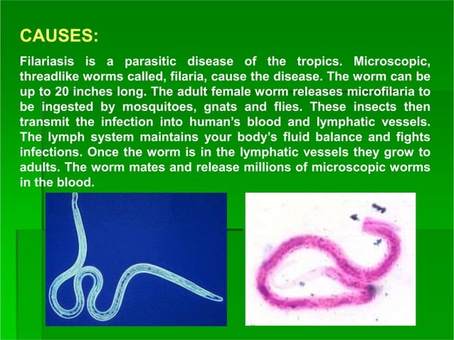 Elephantiasis presentation1 | PPSX | Infectious Diseases | Diseases and Conditions