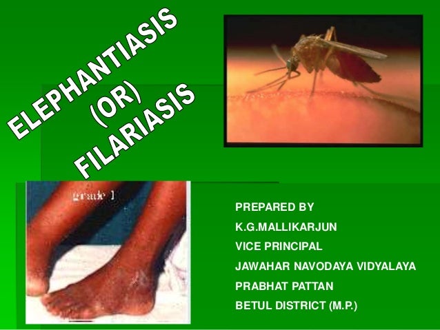 Elephantitis Elephantiasis Symptoms Treatment Pictures