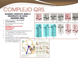 ELETROCARDIOGRAMA PATOLOGICO PARA INTERPRETACION | PPTX