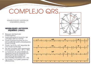 ELETROCARDIOGRAMA PATOLOGICO PARA INTERPRETACION | PPTX