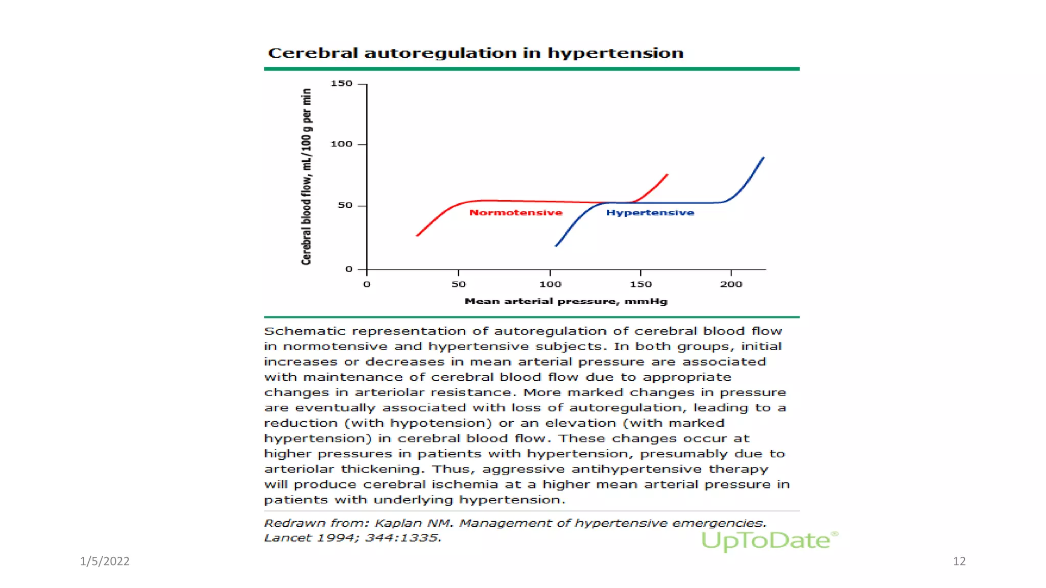 Elevated intracranial pressure (icp) in children | PPT