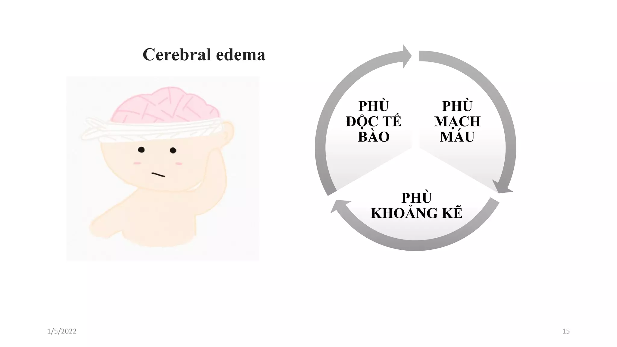 Elevated intracranial pressure (icp) in children | PPT
