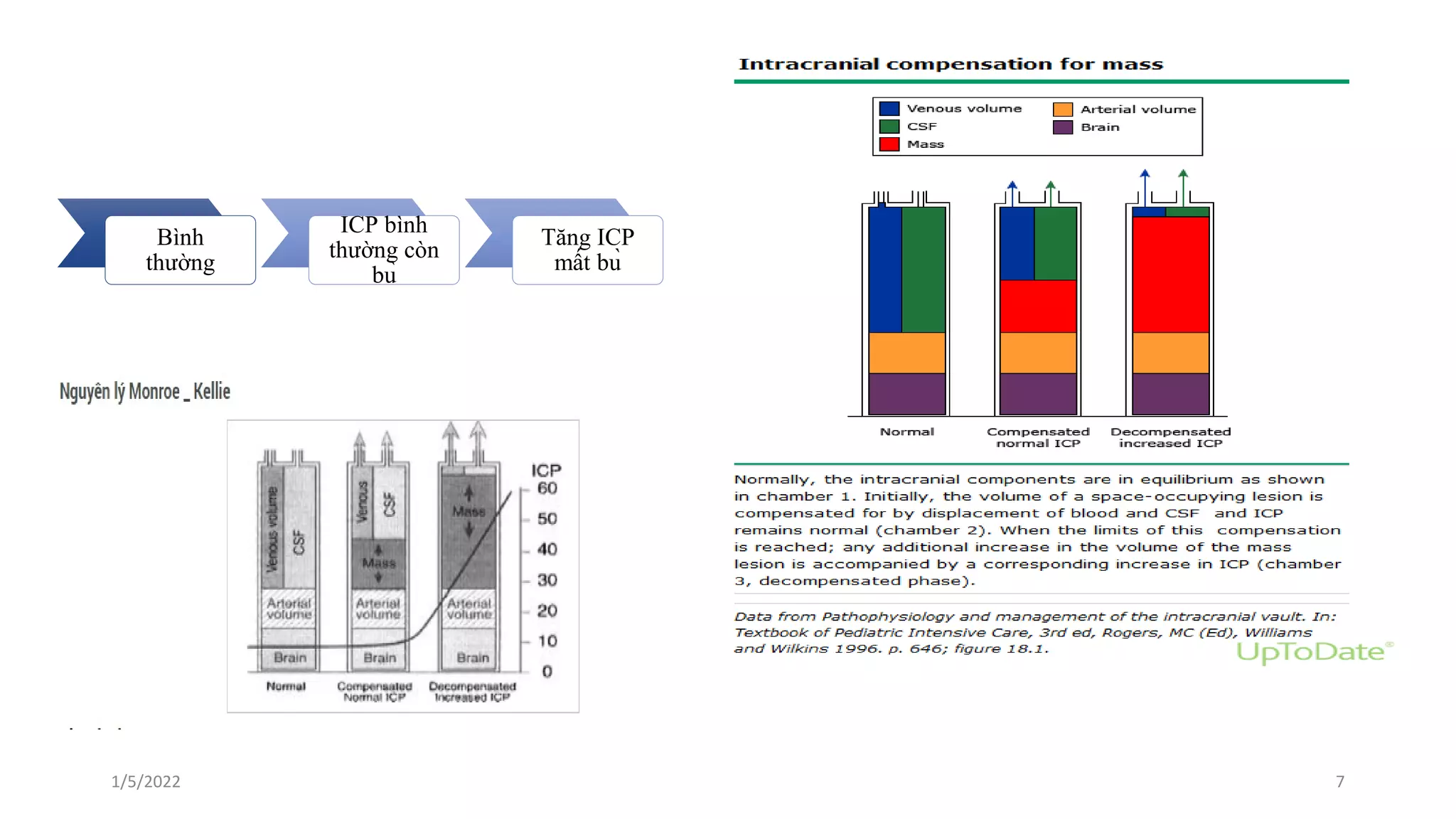 Elevated intracranial pressure (icp) in children | PPT